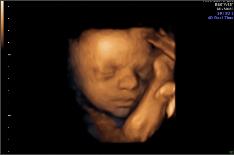 26 week unborn baby. Barefoot Babies. Ultrasounds of Fayetteville and ...